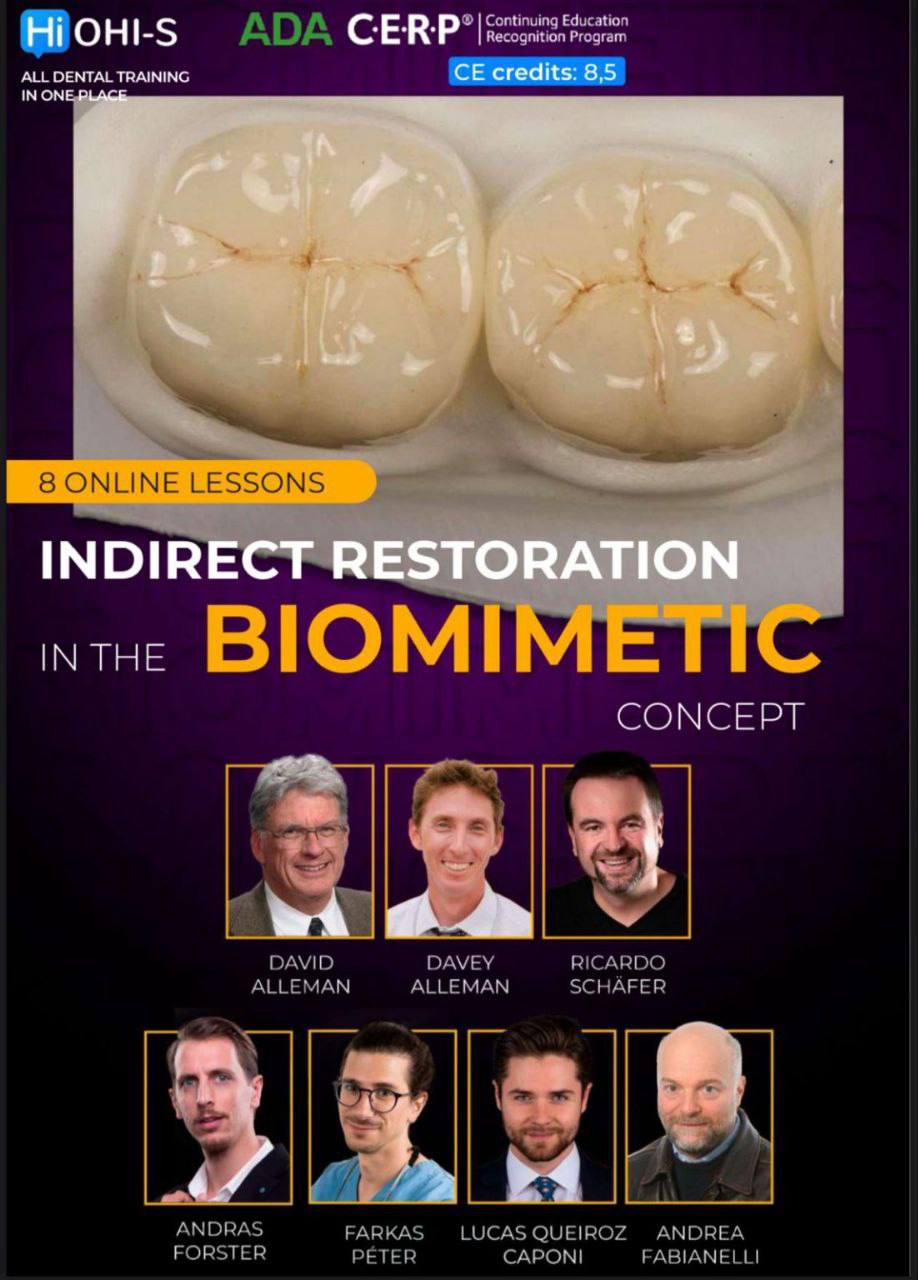 OHI-S Indirect Restoration in the Biomimetic Concept - Medical amboss