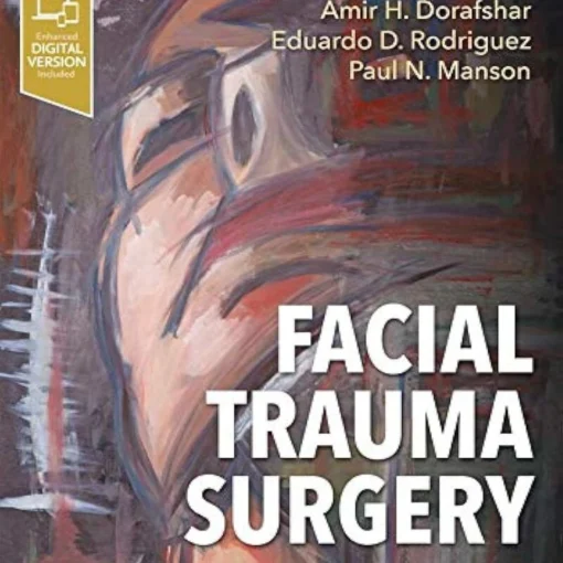 Facial Trauma Surgery: From Primary Repair To Reconstruction ...