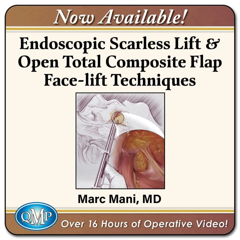 Scarless Endoscopic & Open Composite Plane Face-lifting Techniques 2025 ...